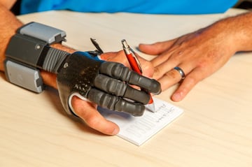 Prosthetic Options for Varying Levels of Finger/Hand Differences or Loss
