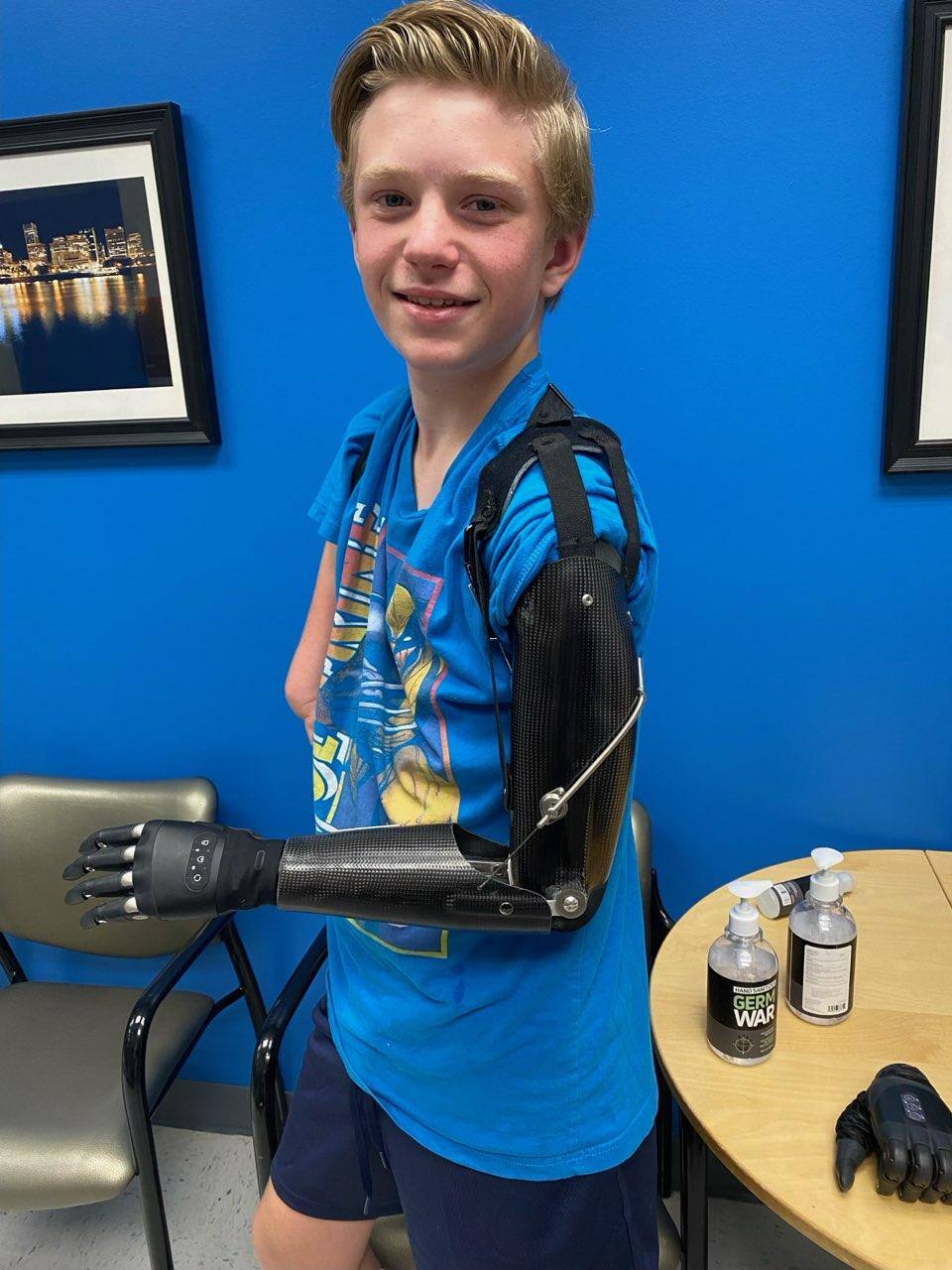 Setting Him Up for Success: Jameson’s Experience with a Congenital ...