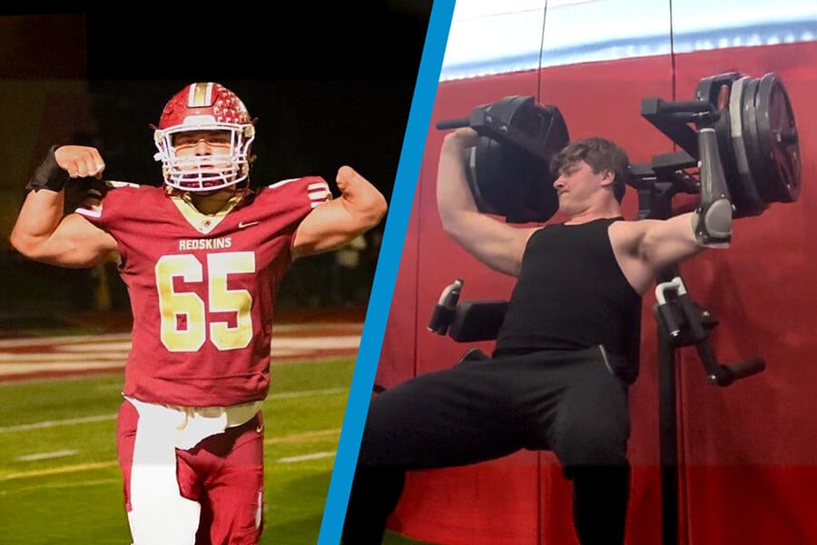 The Upper Limb Library