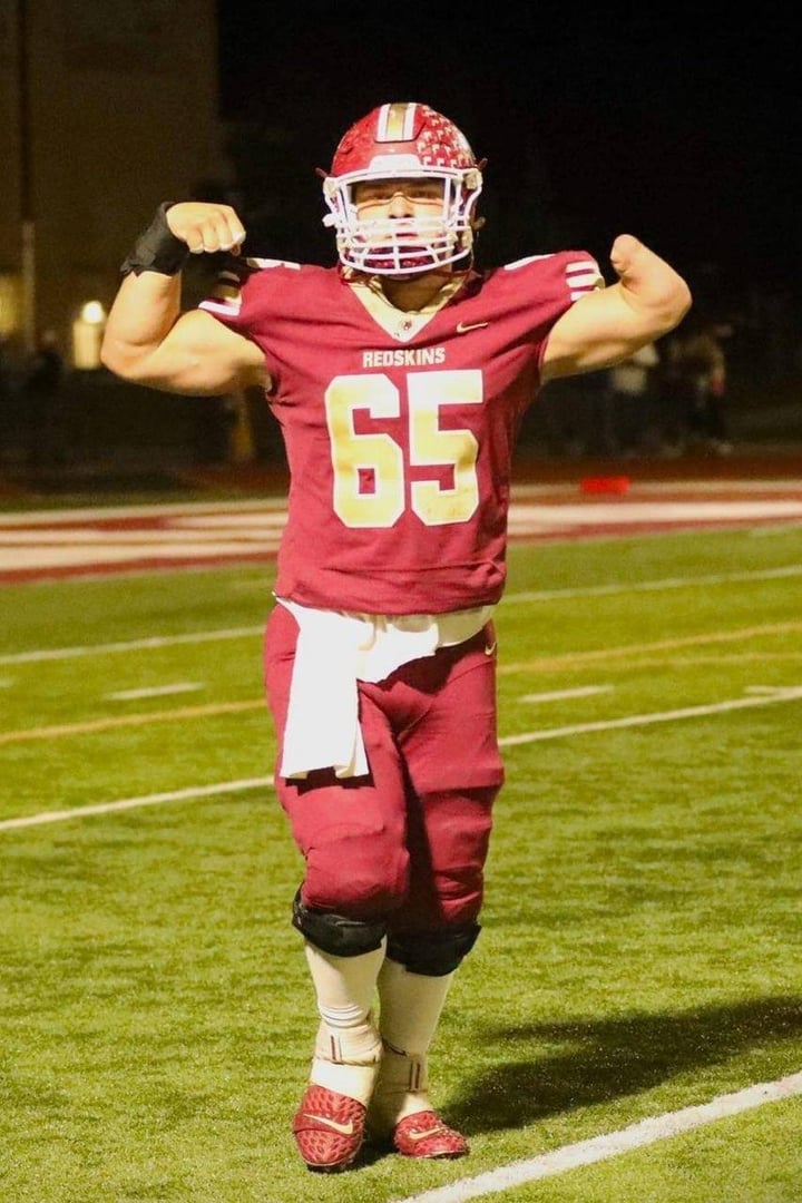 High School Football Captain, Weightlifter, Limb Different: Dakota at 17