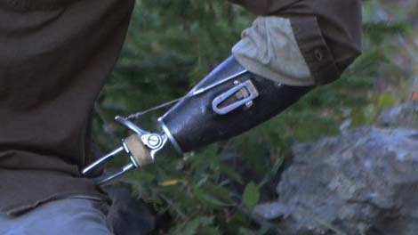 I did a photo shoot with my bionic arm, and it makes me look like a ...