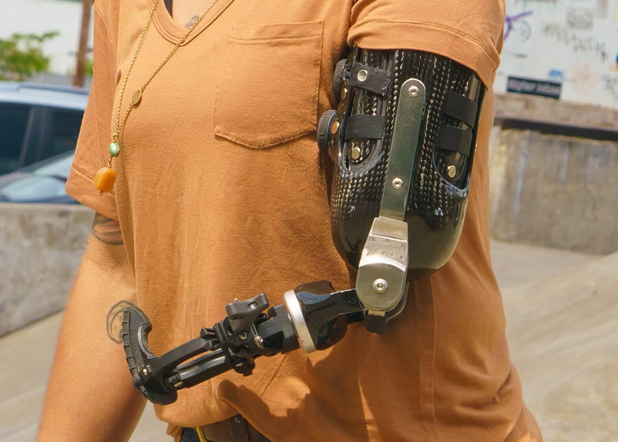 Harnesses and Upper Limb Prostheses