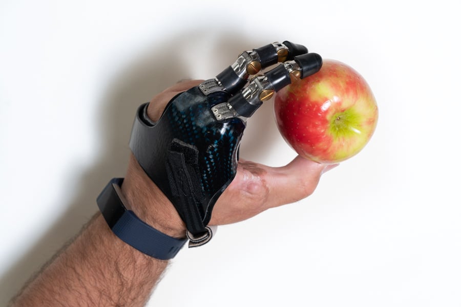 Passive And Custom Silicone Restoration Prostheses An Excellent Functional Option