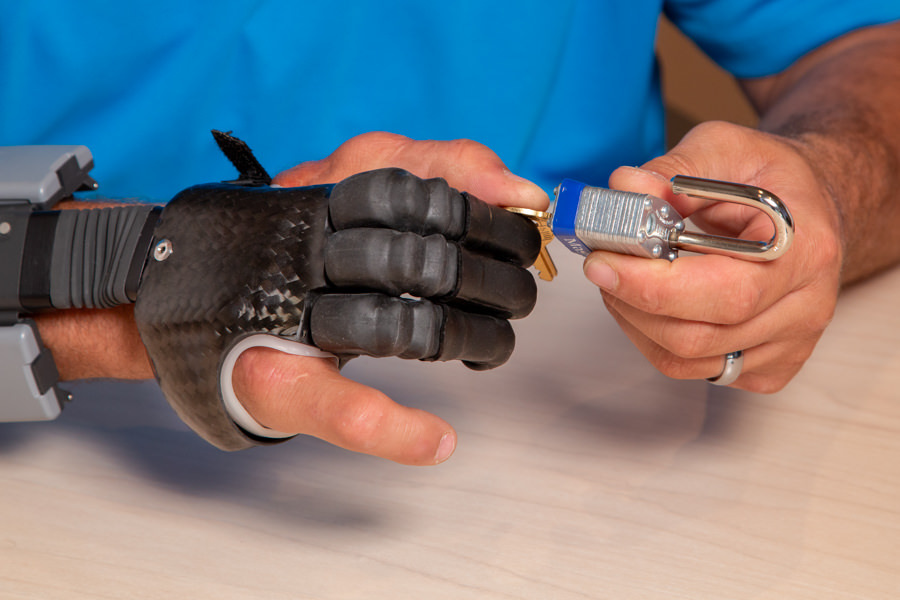 Partial Hand Limb Differences: Through the Palm