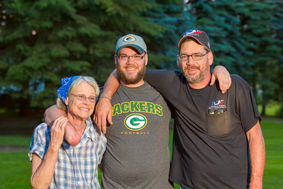 Taking Off With an Upper Limb Prosthesis: What You Need to Know