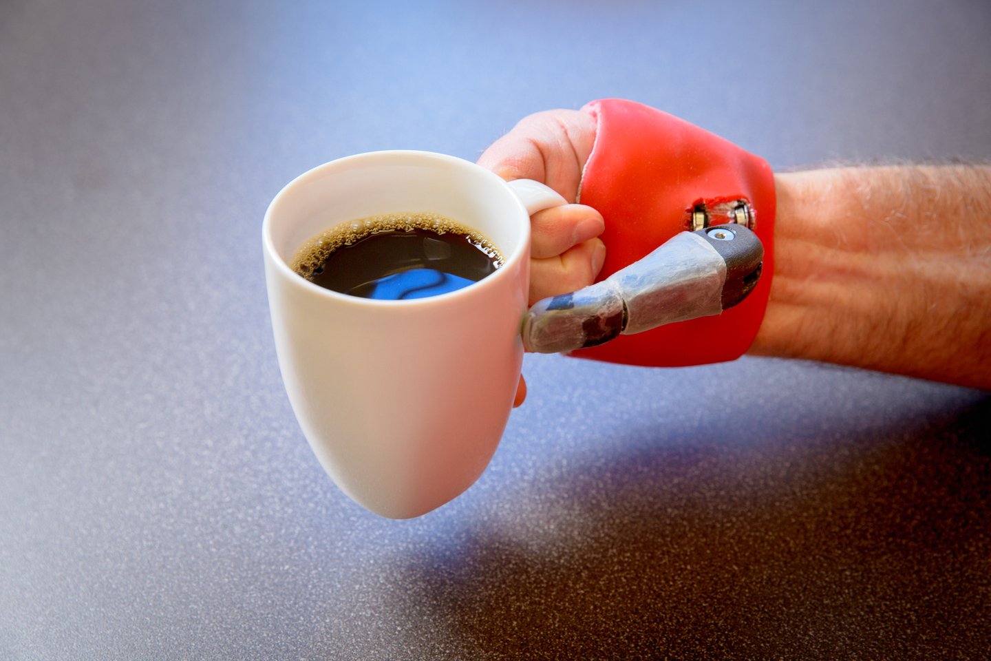 Commonly Used Terms That New Amputees Should Know