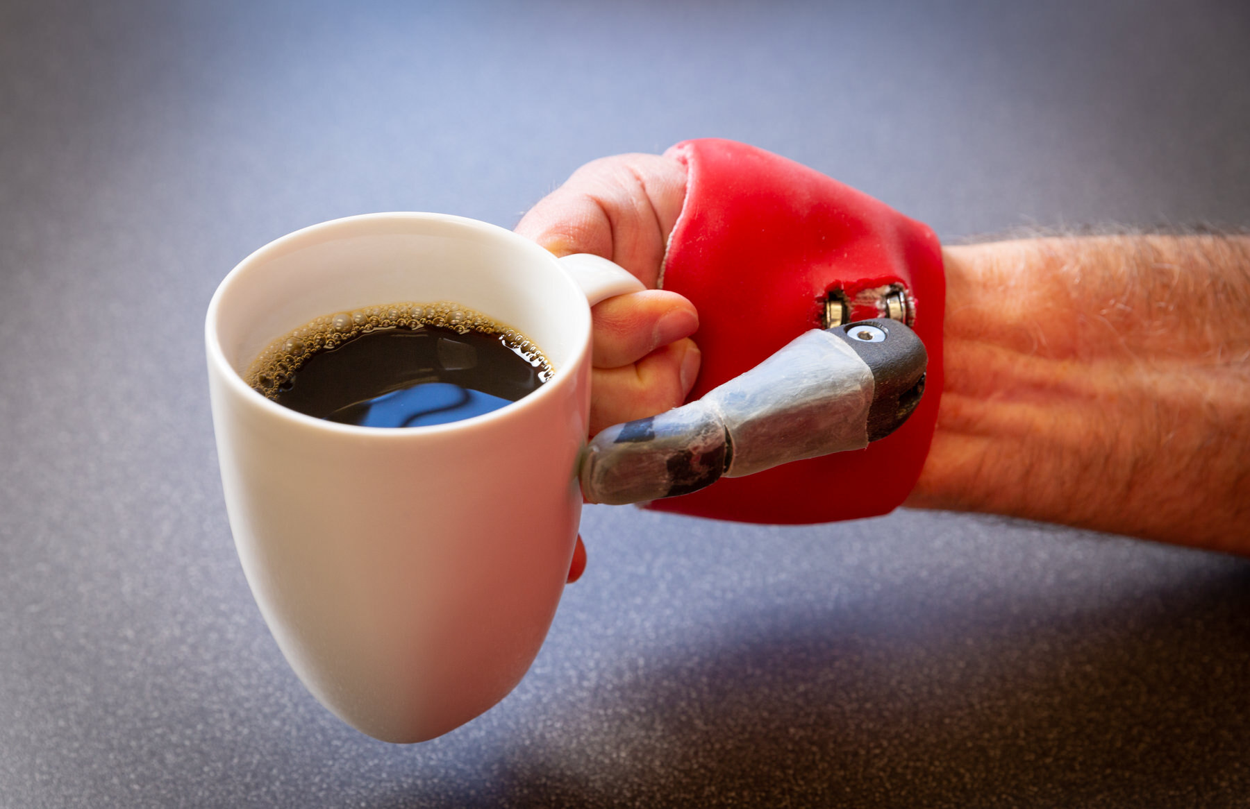 Upper Limb Prostheses That Combine Function with Realism