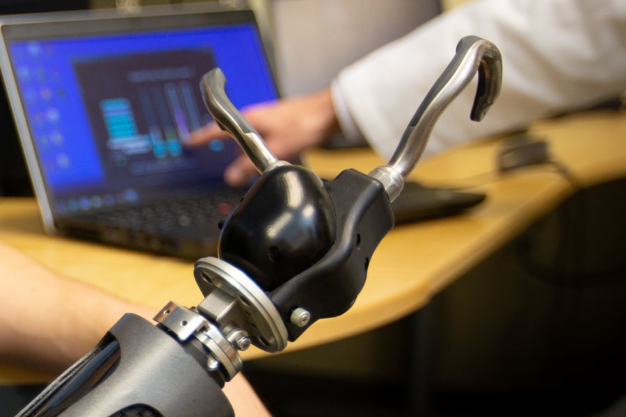 Introduction to Myoelectric Prostheses