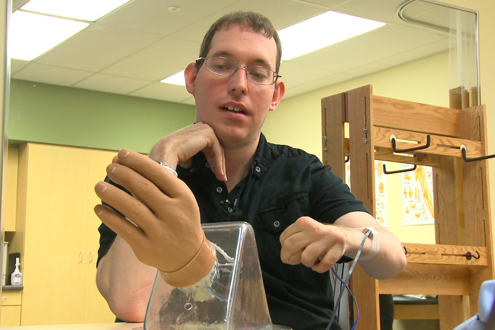 Getting Back to Work After an Upper Limb Amputation