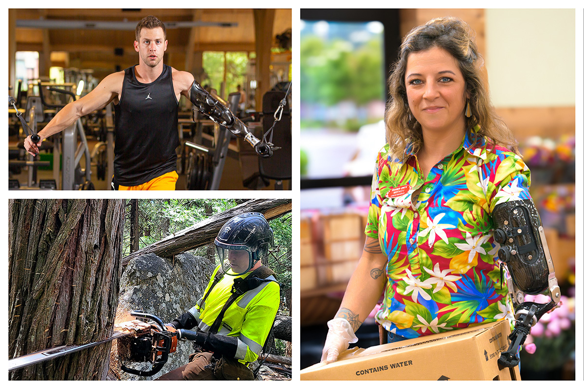 Introduction to Activity-Specific Prostheses