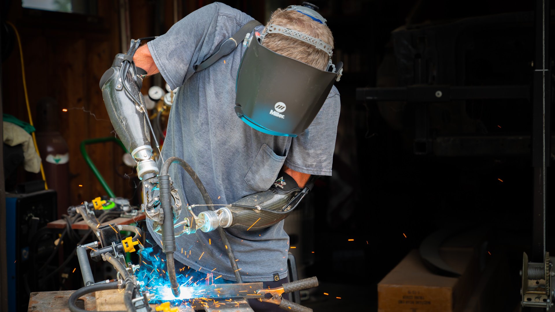 Prosthetic Options | Arm Dynamics