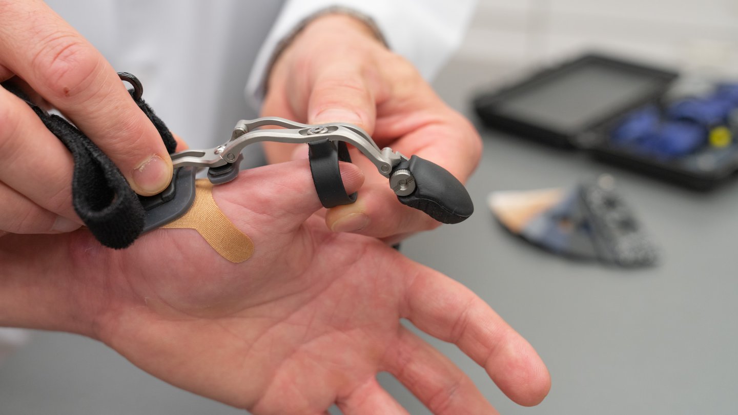 Prosthetic Options | Arm Dynamics