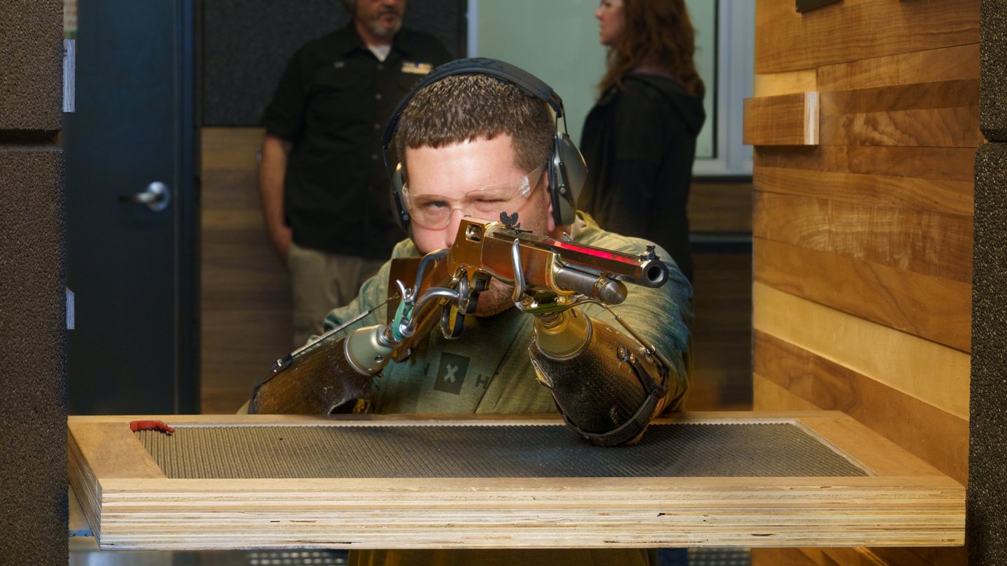 Prosthetic Options | Arm Dynamics