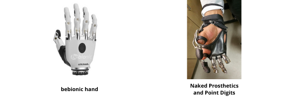 Five Keys to Understanding the Emotional Impact of Upper Limb Loss