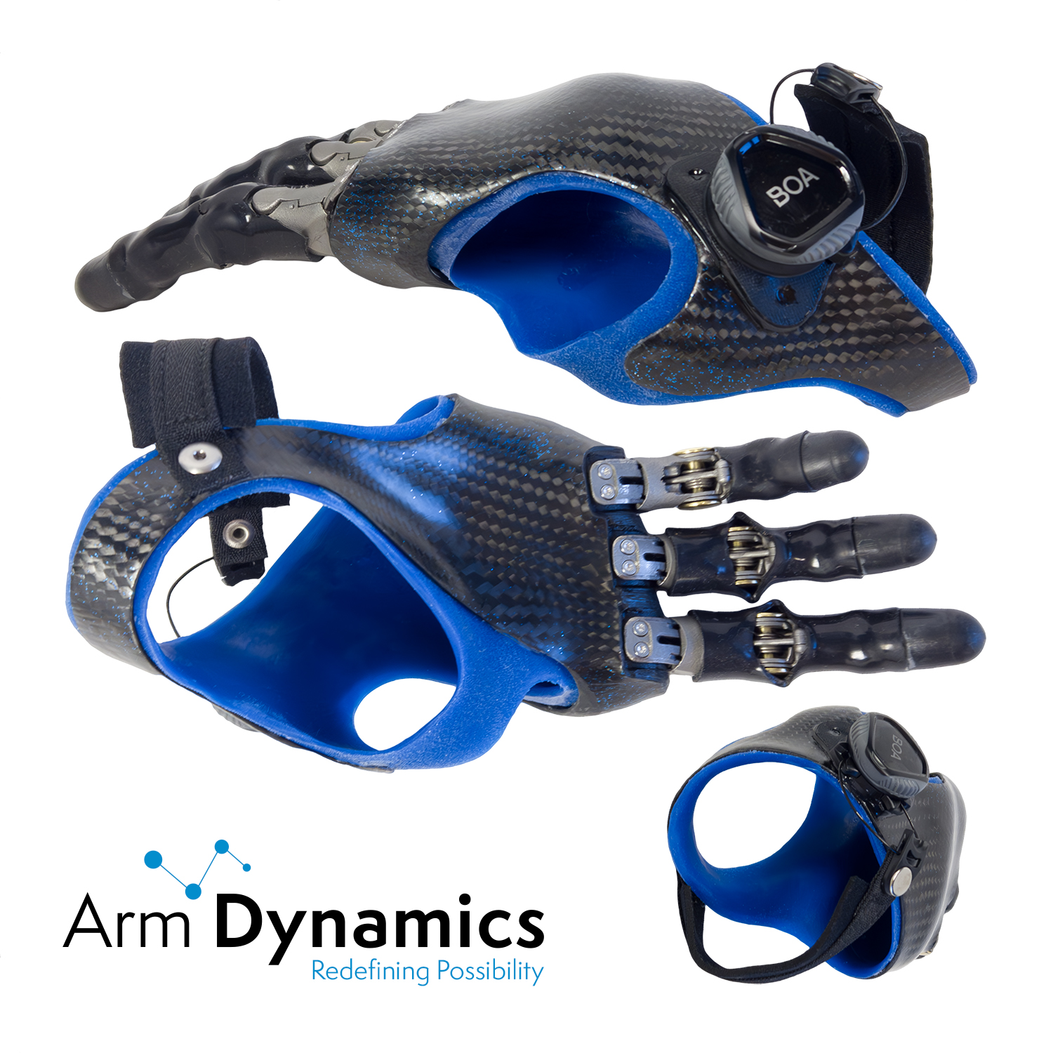 Donning and Doffing Your Upper Limb Prosthesis