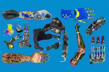 How Are Prosthetic Arms, Hands and Partial Hands Fitted?
