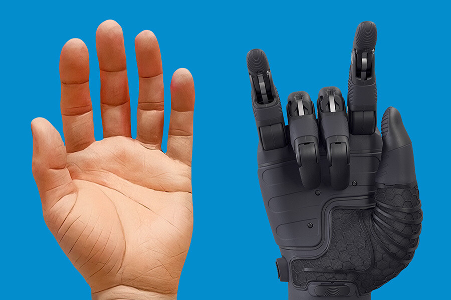 Better Choices for People with Partial Hand and Finger Loss