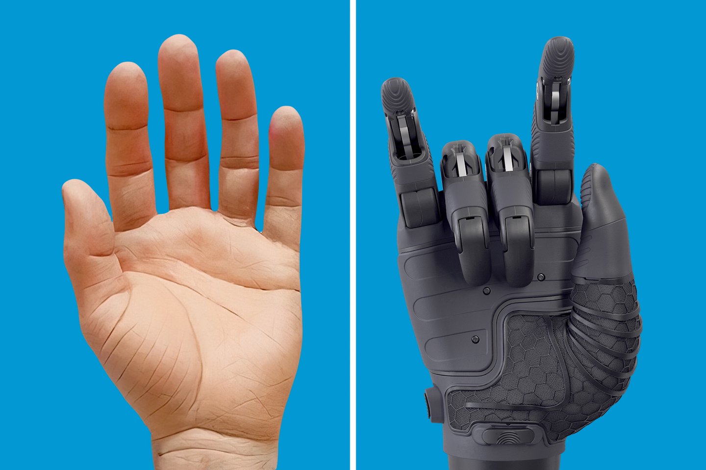 Better Choices for People with Partial Hand and Finger Loss