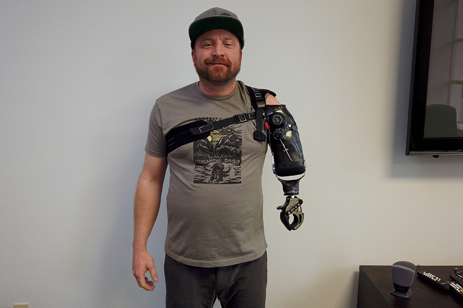 Introduction to Phantom Limb Pain and Phantom Sensations