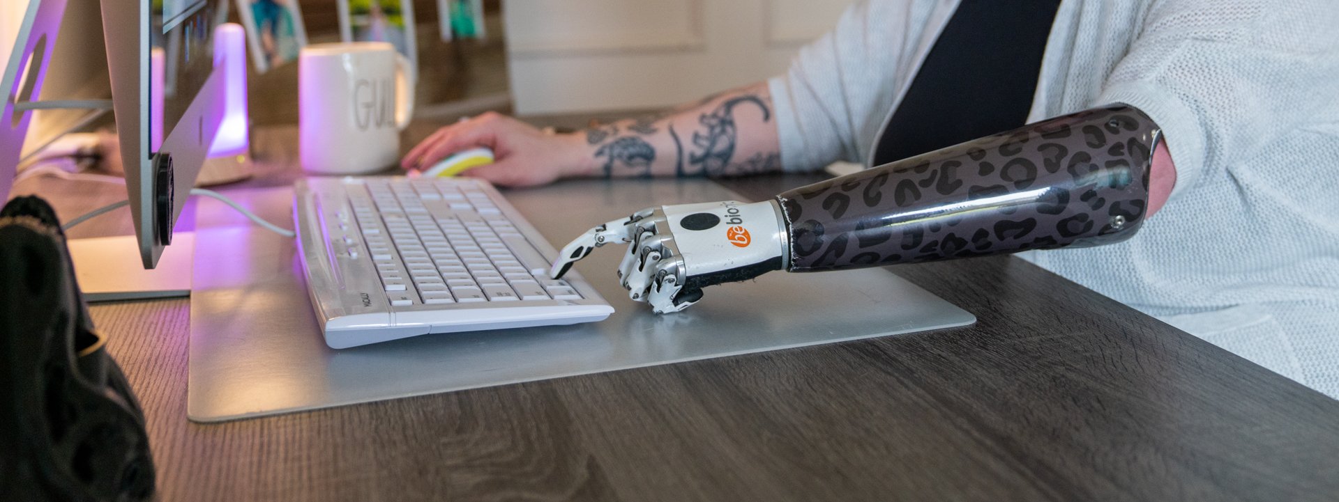 The Comprehensive Arm Prosthesis and Rehabilitation Outcomes ...