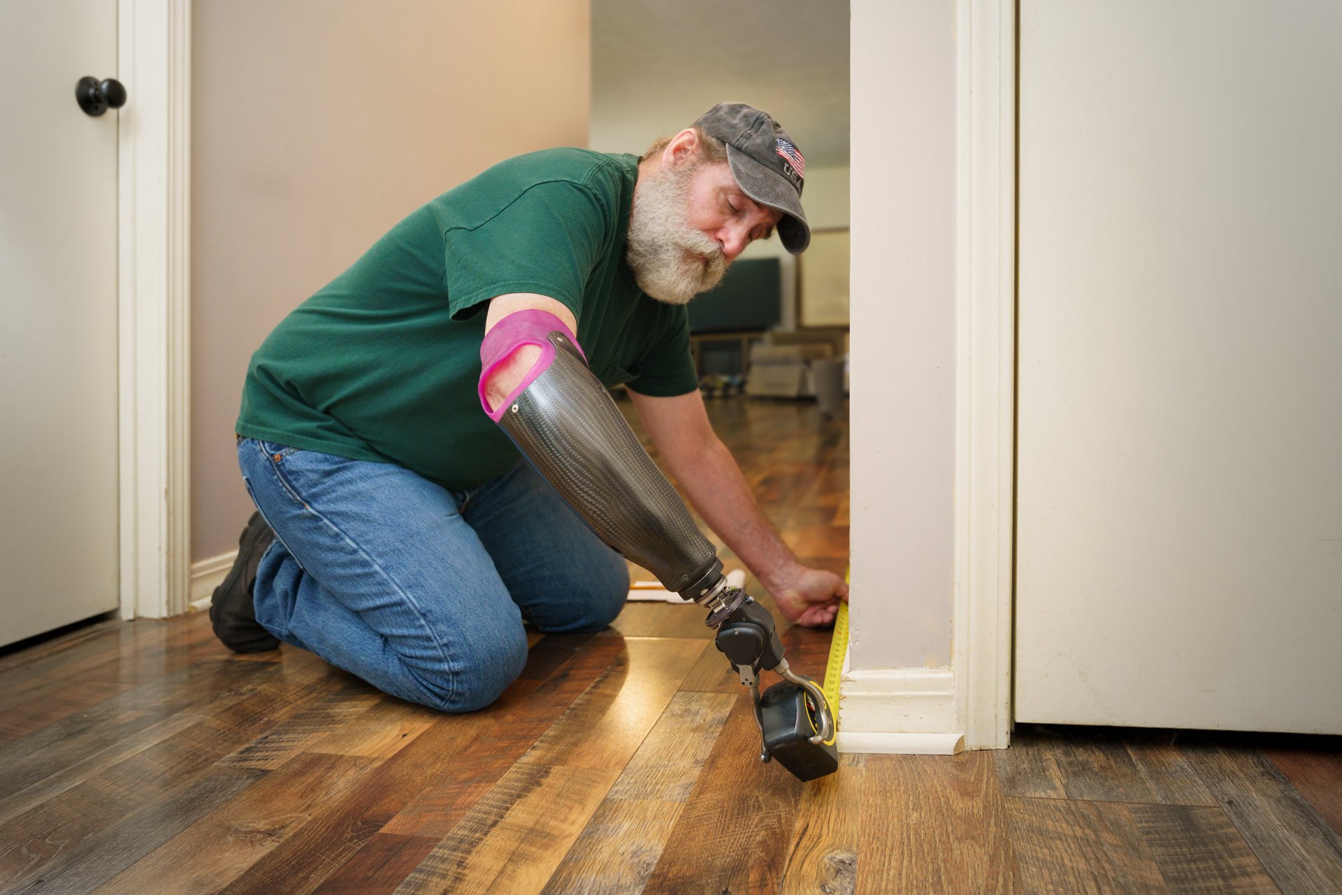 Prosthetic Options for Wrist Disarticulations