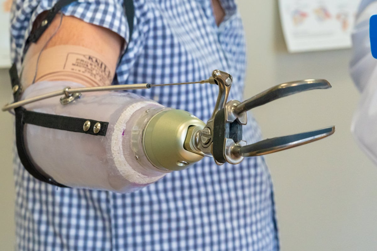 Introduction to Body-Powered Prostheses