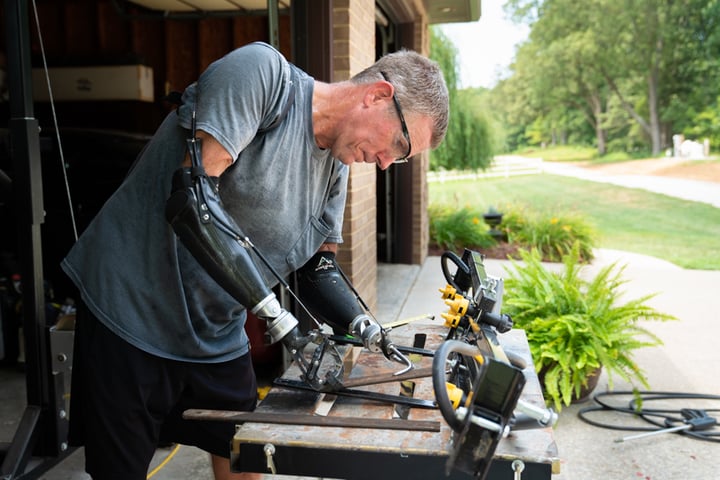 Five Keys to Understanding the Emotional Impact of Upper Limb Loss