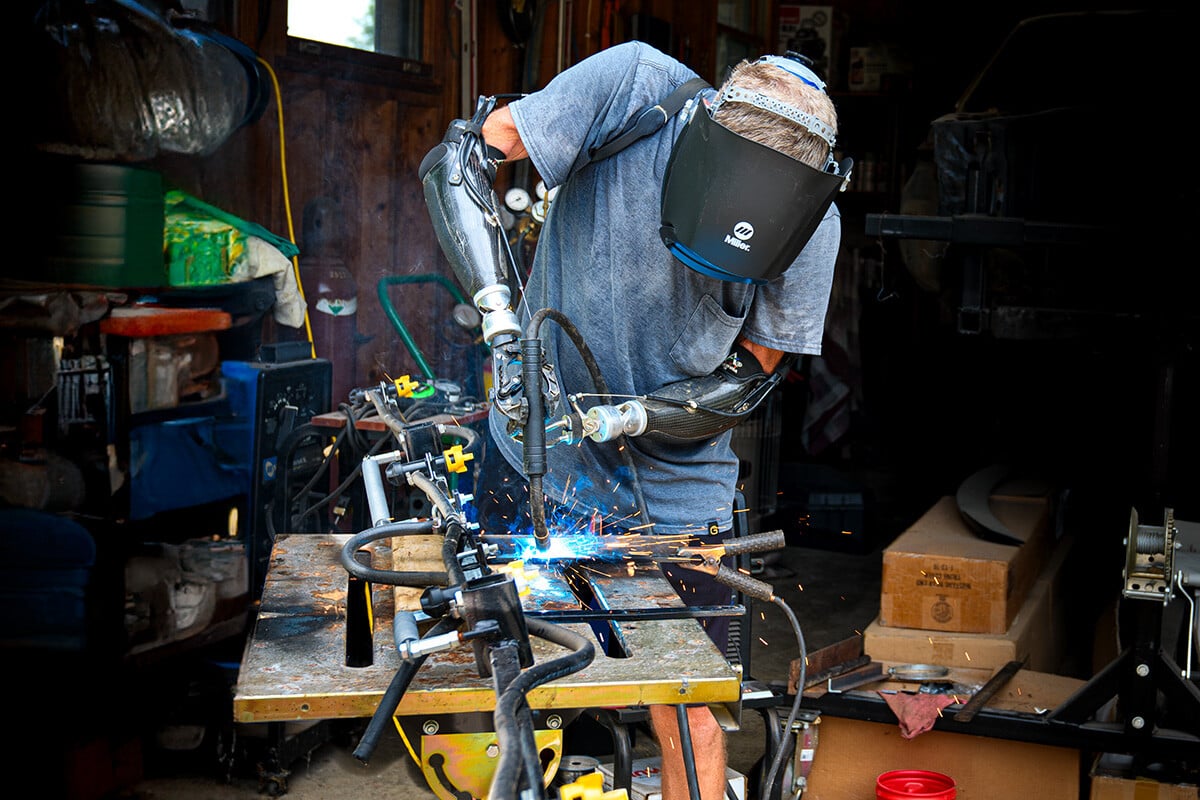 The Process of Getting a Prosthetic Device: From Start to Finish