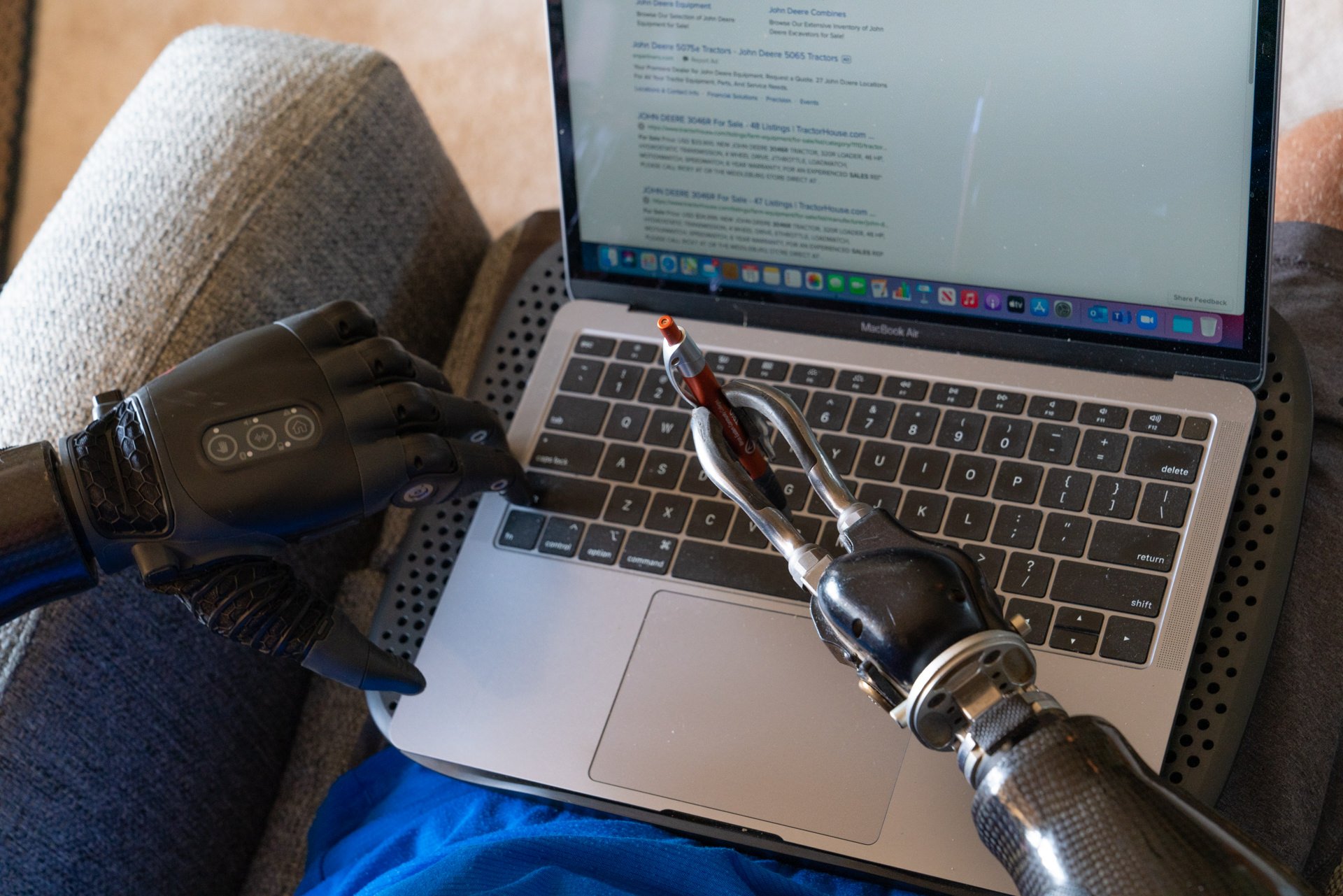 Typing and Texting with an Upper Limb Prosthesis