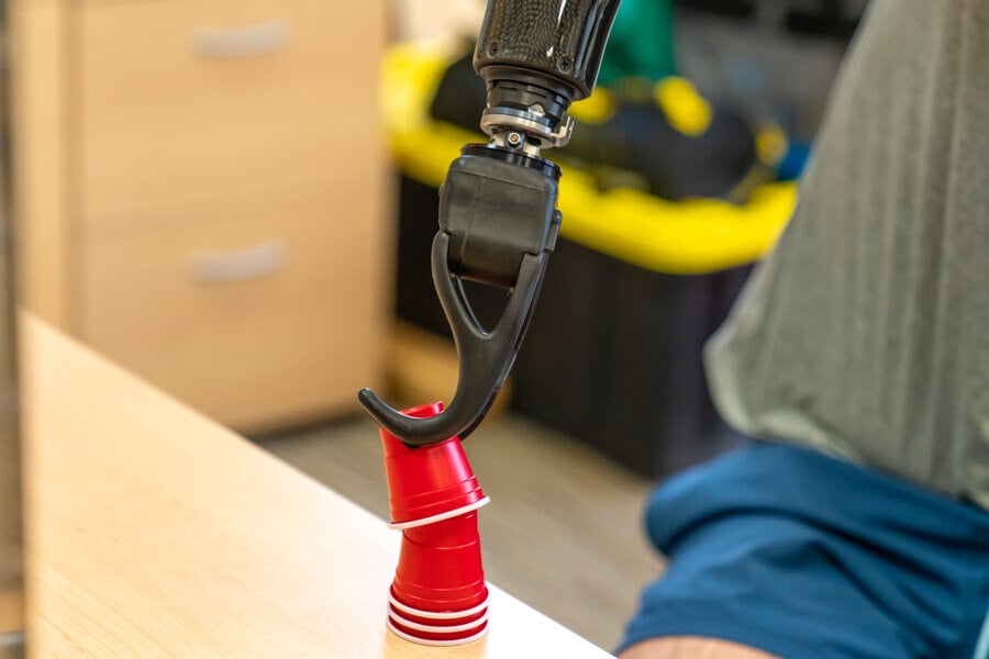 Prosthetic Options for Wrist Disarticulations