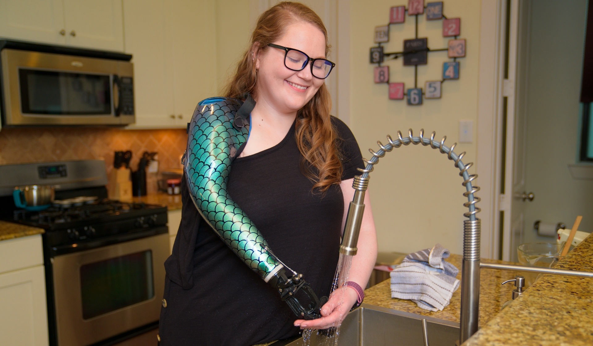 Harnesses and Upper Limb Prostheses