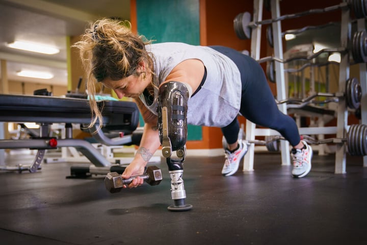 Limb Loss and Limb Difference Awareness Month: Wendi’s Perspective