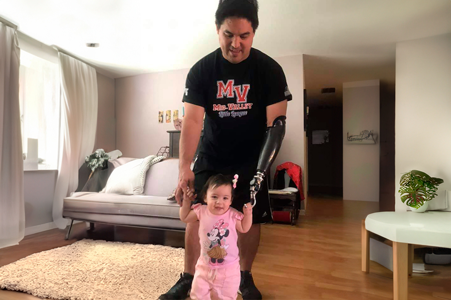Elective Amputations: Darren’s Perspective