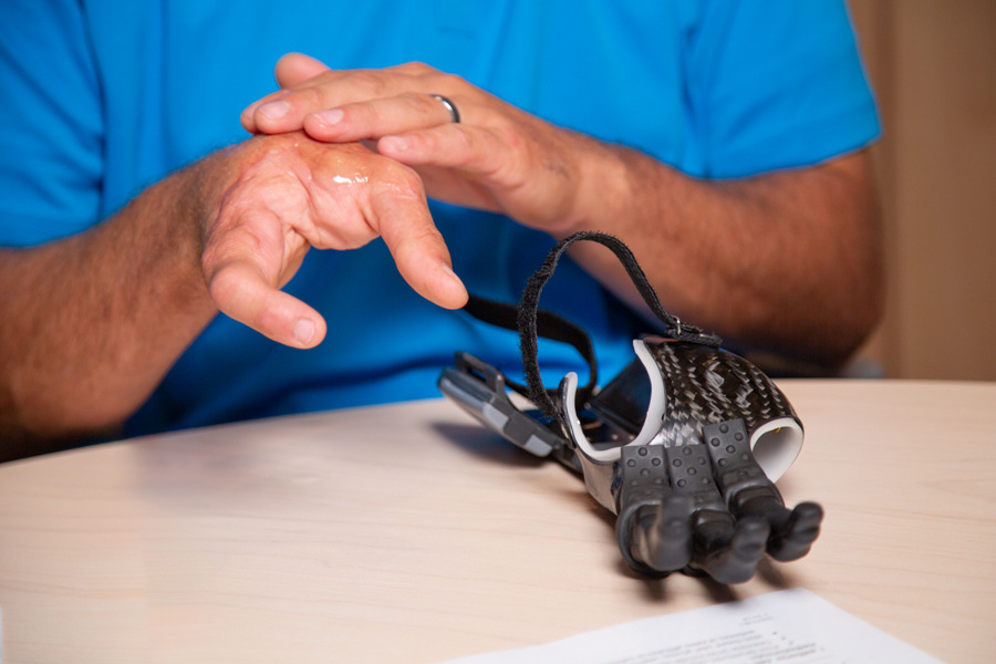 Introduction to Passive Prostheses