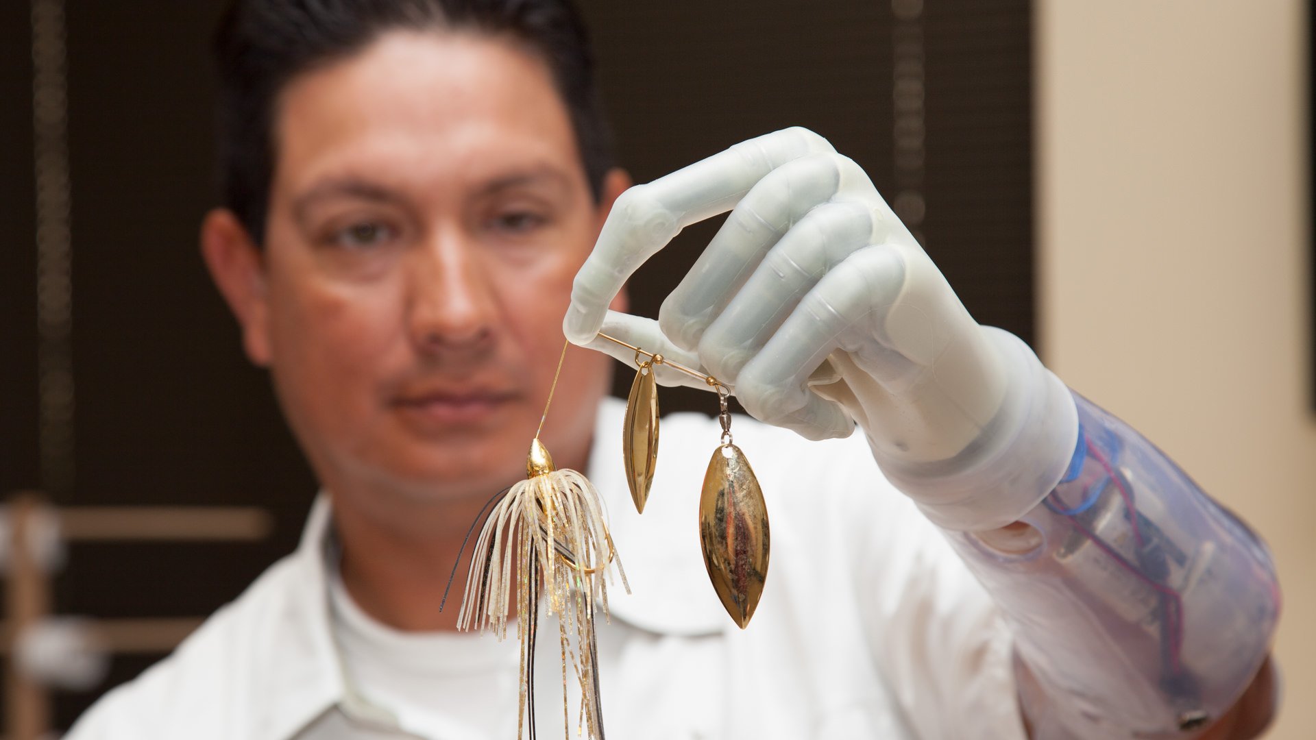 Prosthetic Options | Arm Dynamics