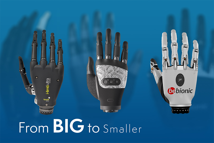 Introduction to Myoelectric Prostheses