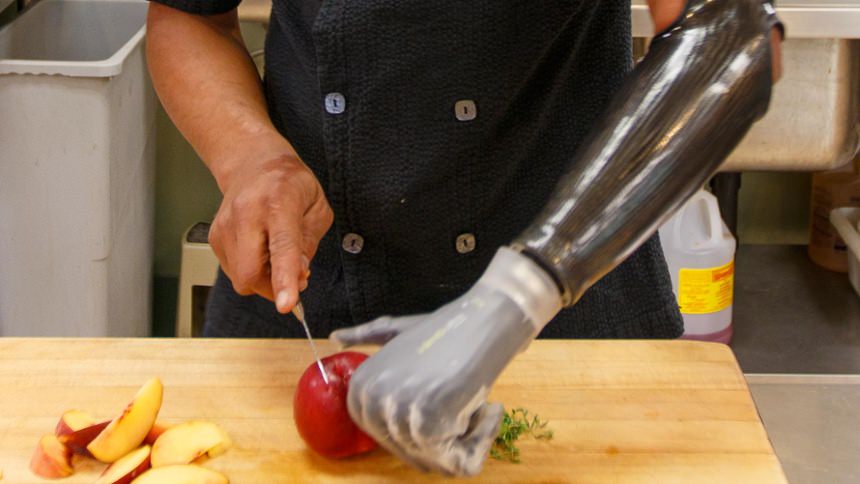 Eduardo Garcia | Patient Profile | Arm Dynamics