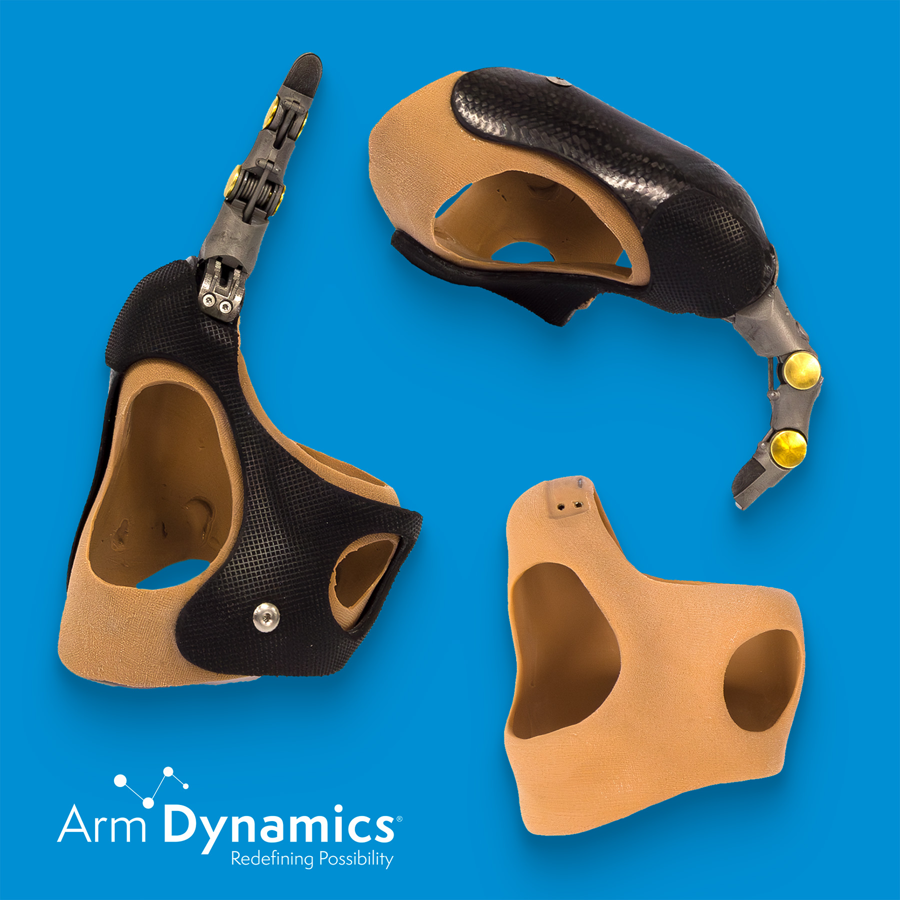 Prosthetic Options for Varying Levels of Finger/Hand Differences or Loss