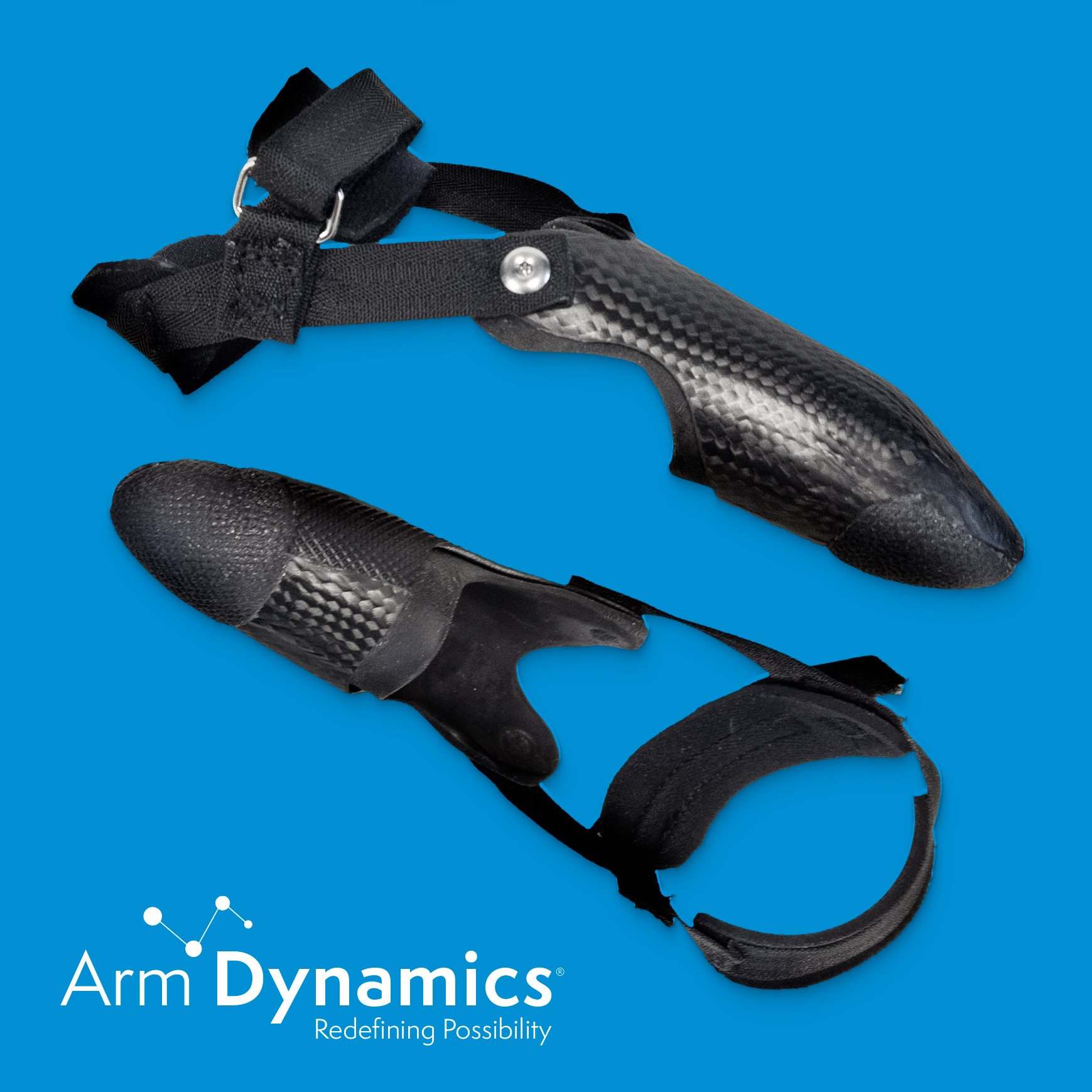 Prosthetic Options for Partial Thumb Amputations or Differences