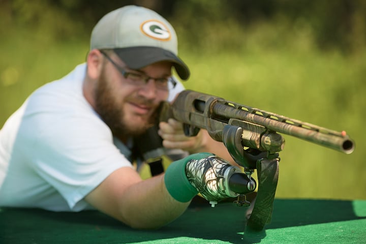 The Upper Limb Library | Amputation Levels