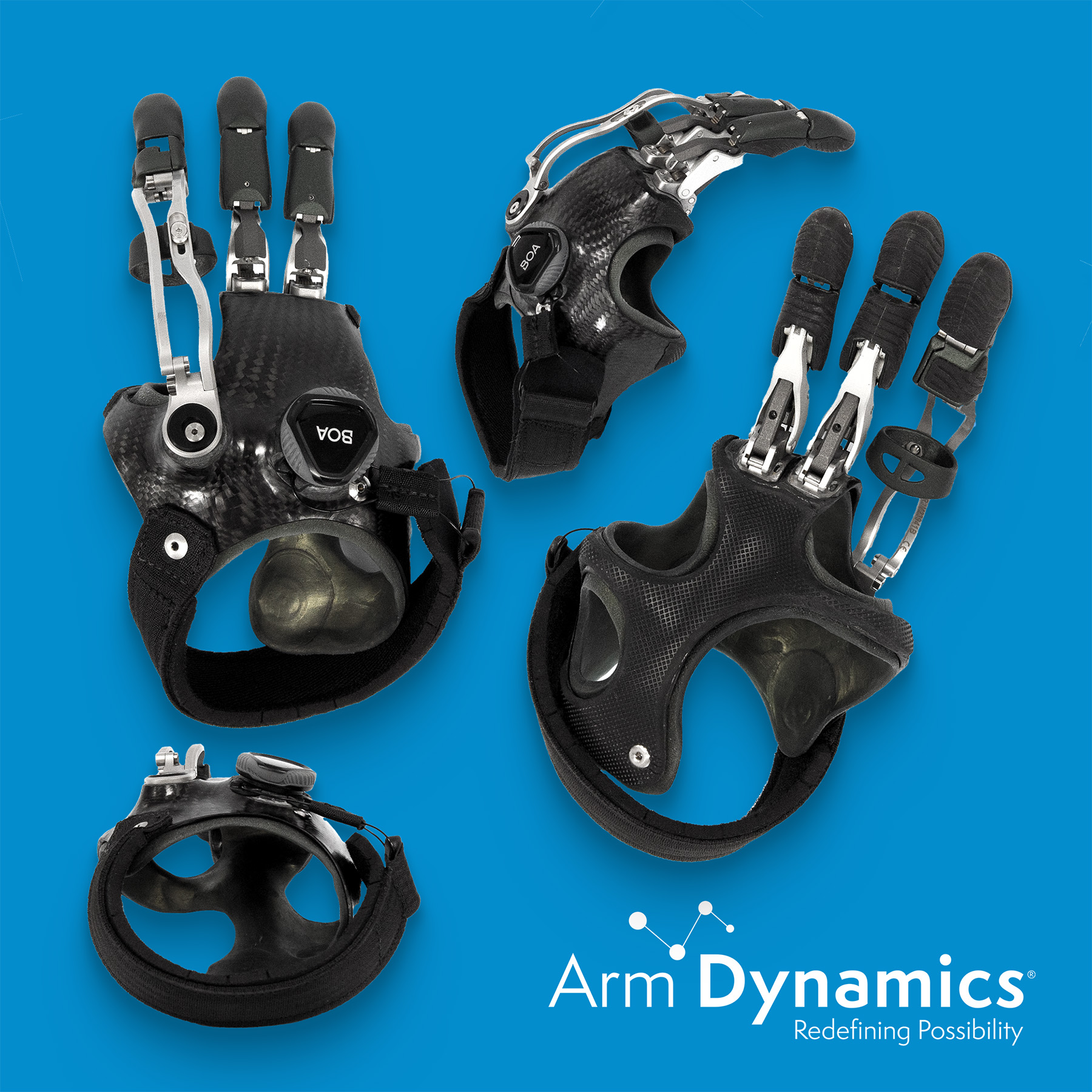 Prosthetic Options for Varying Levels of Finger/Hand Differences or Loss