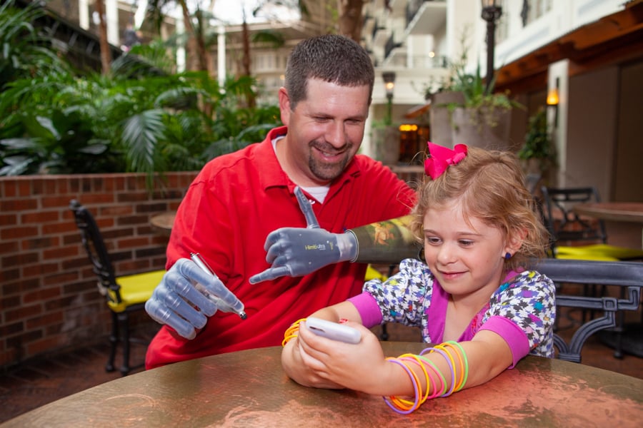 Bilateral Upper Limb Loss