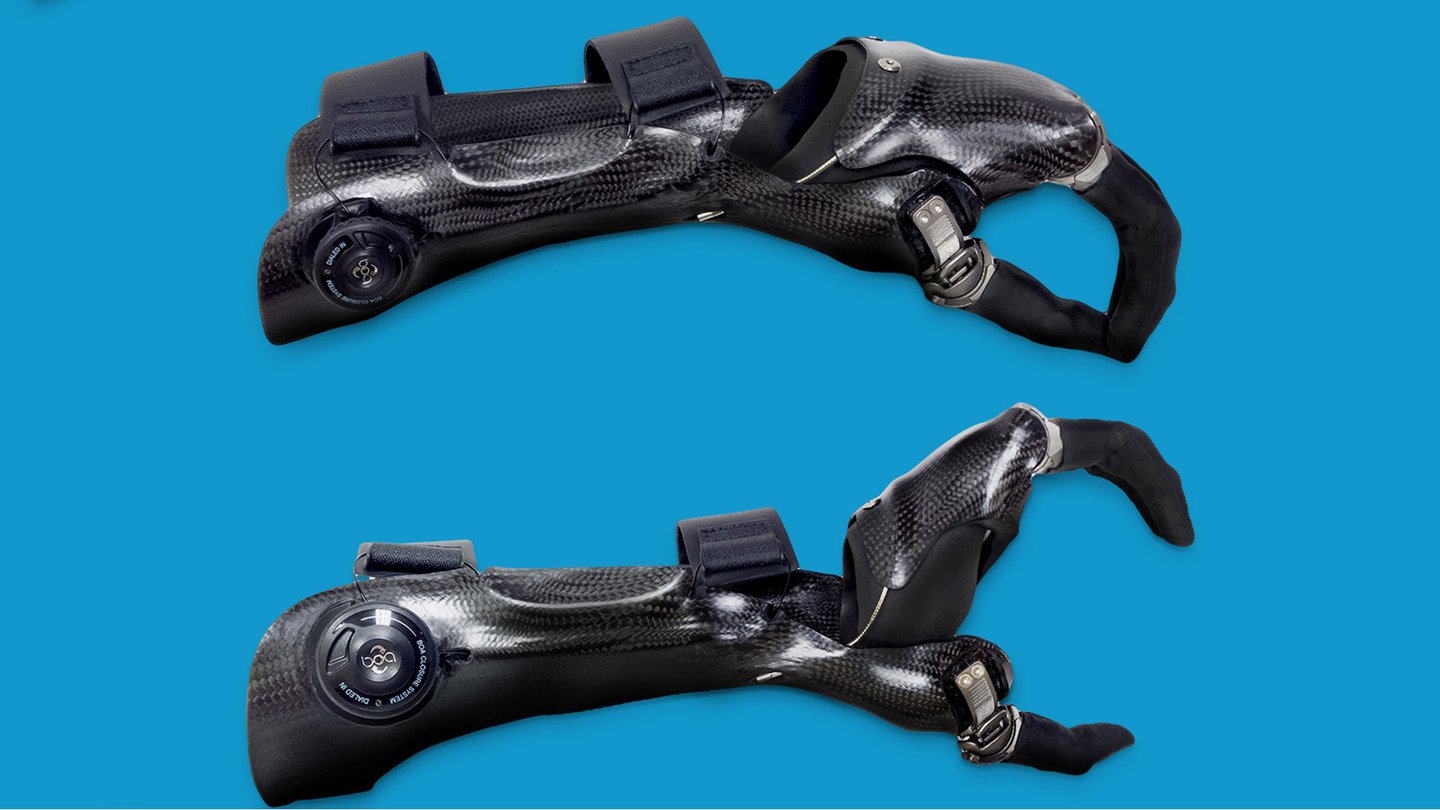 What is a Hybrid Upper Limb Prosthesis?