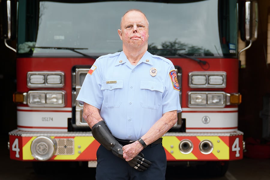 Custom Silicone Sockets: The Ultimate in Comfort and Control for ...