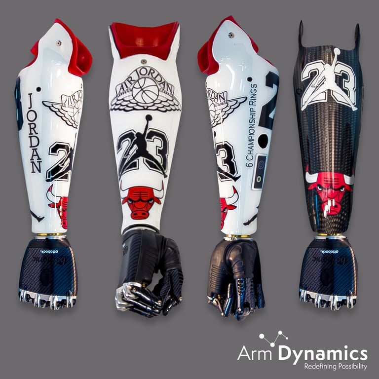 Creativity and Prosthetic Devices