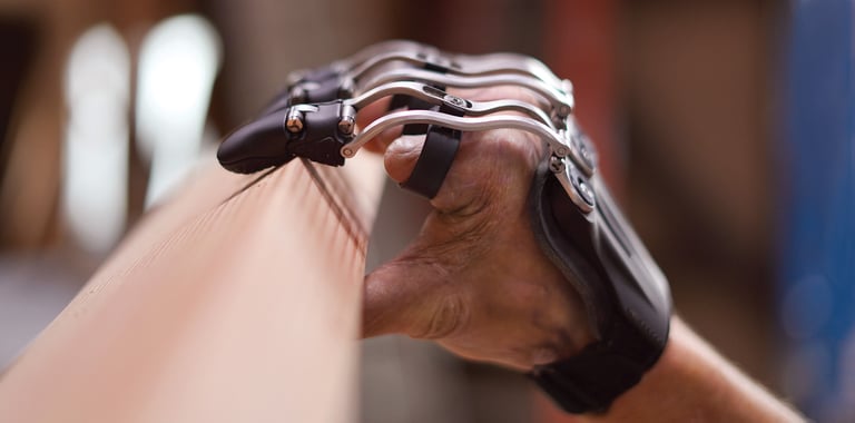 Modern, functional prosthetic solutions for finger and partial hand ...