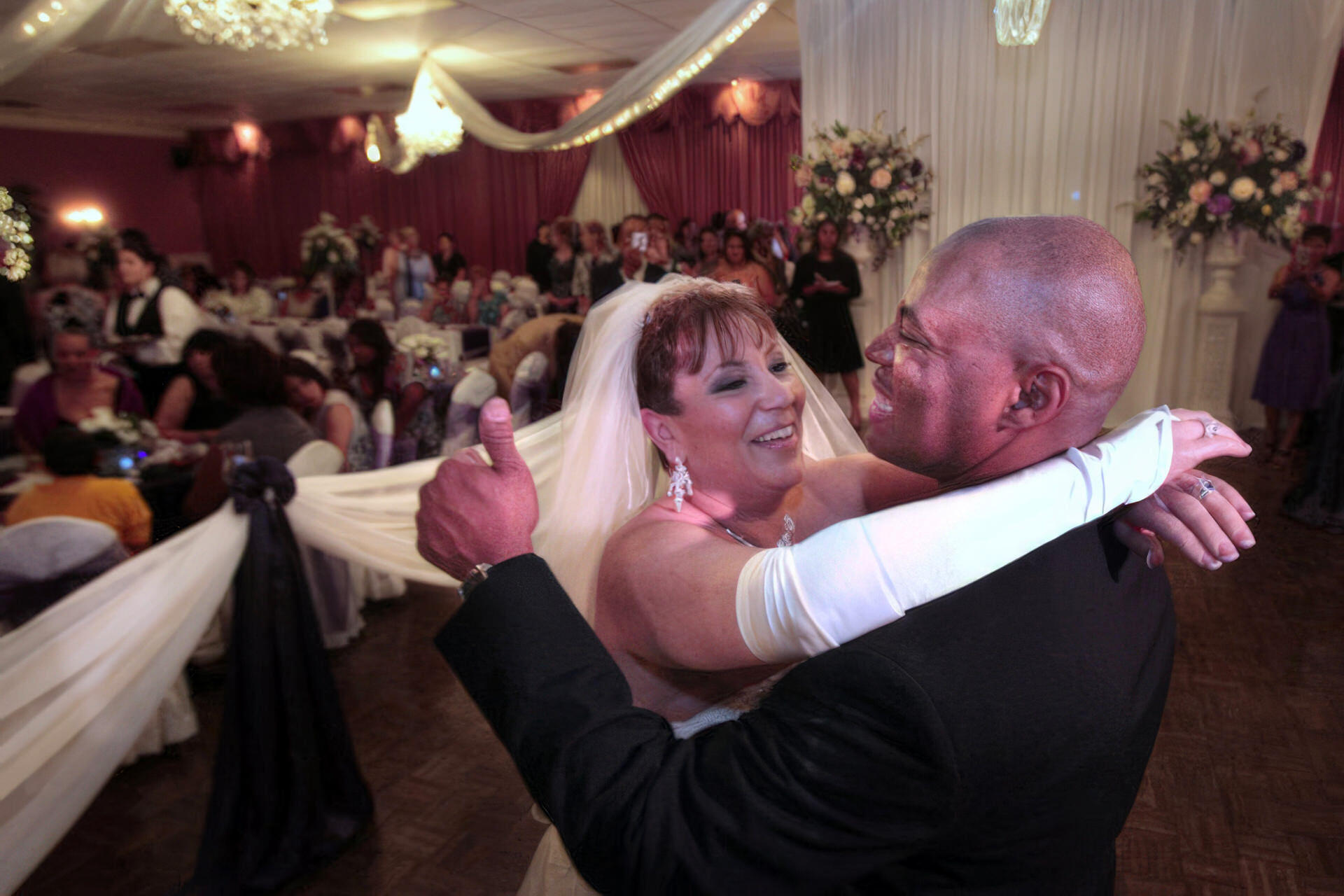 Weddings and Upper Limb Prostheses
