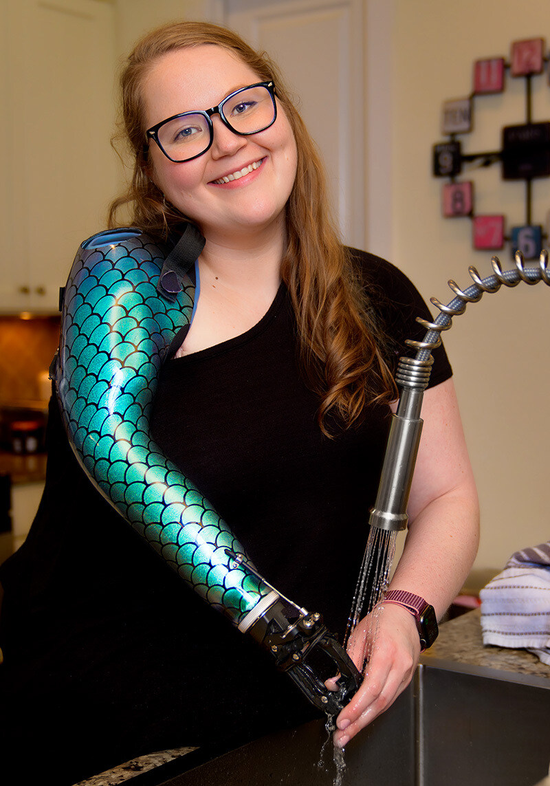 Women and Upper Limb Prostheses