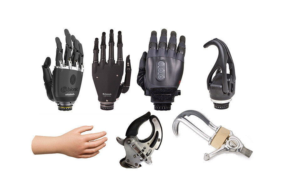 Prosthetic Terminal Devices for Babies, Children and Adolescents with ...