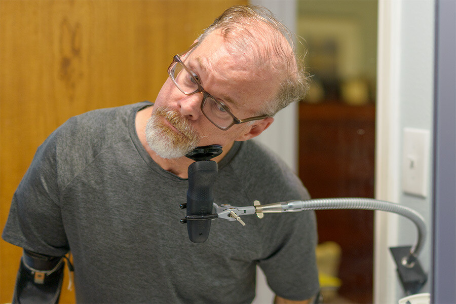 Bilateral Upper Limb Loss